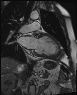 Investigatii cardiace de inalta calitate! RMN CORD disponibil in ...