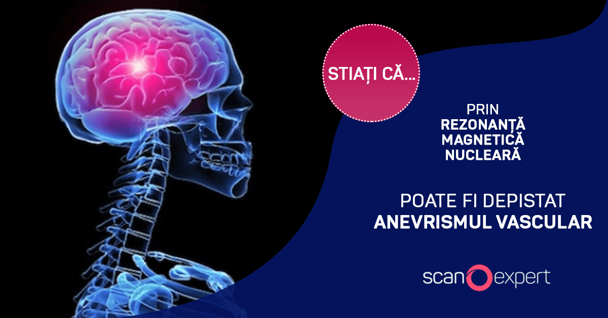 Stiați că ... prin rezonanta magnetica nucleara poate fi depistat ...
